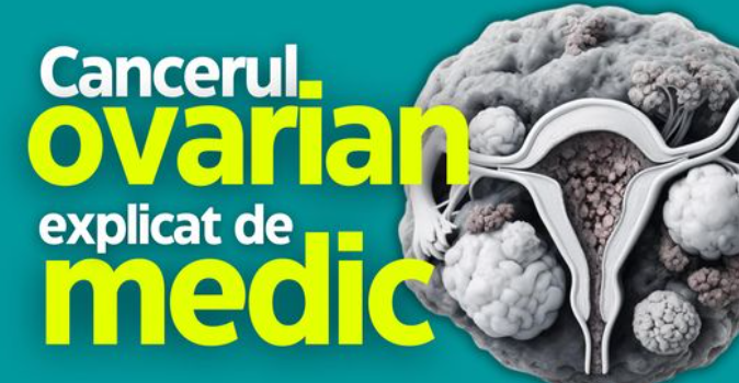 Cancerul ovarian, cel mai letal dintre cancerele feminine ... Cancerul ovarian, cel mai letal dintre cancerele feminine ...